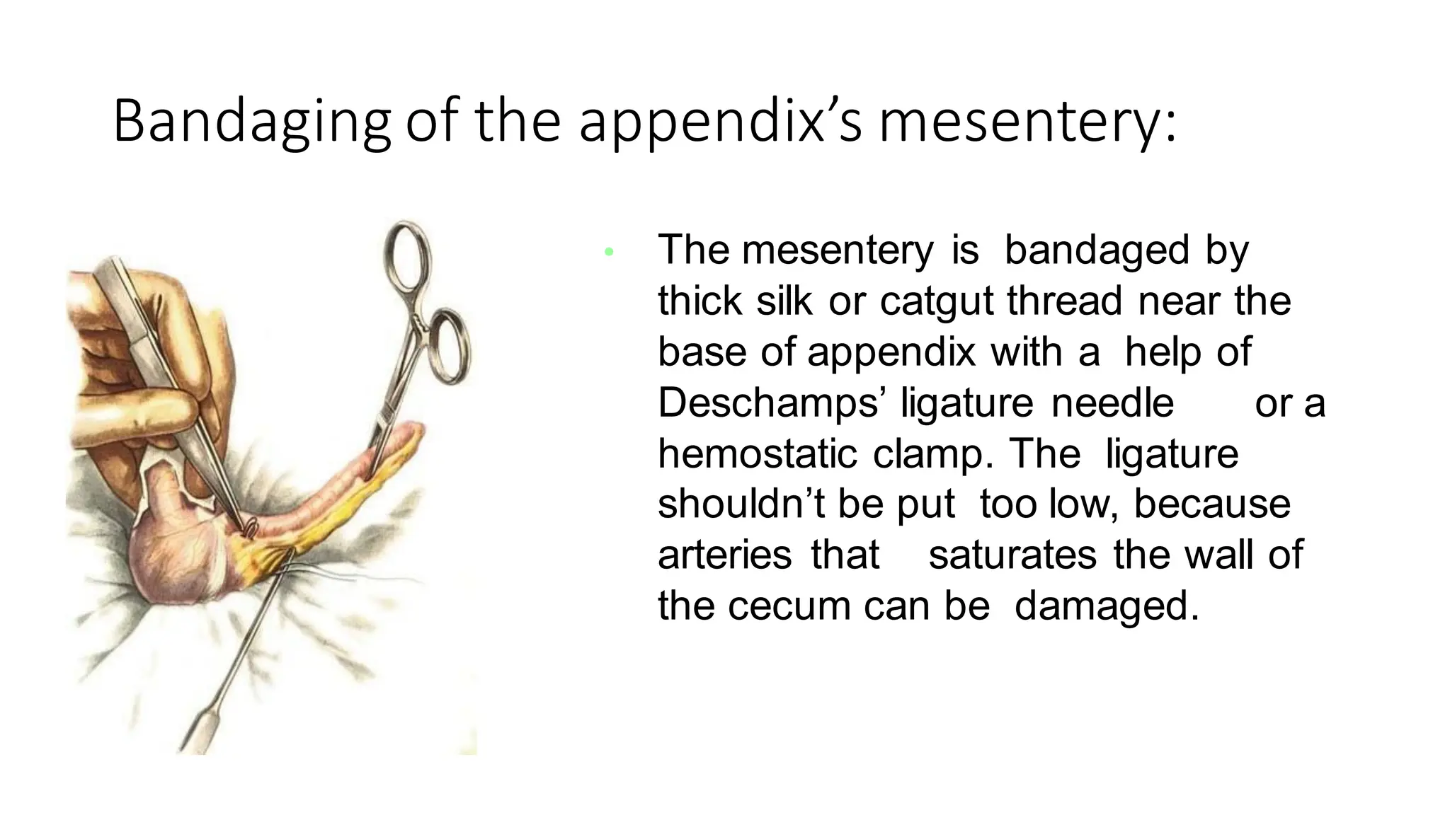 APPENDECTOMY PRESENTATION BY GENERAL SURGERY | PDF
