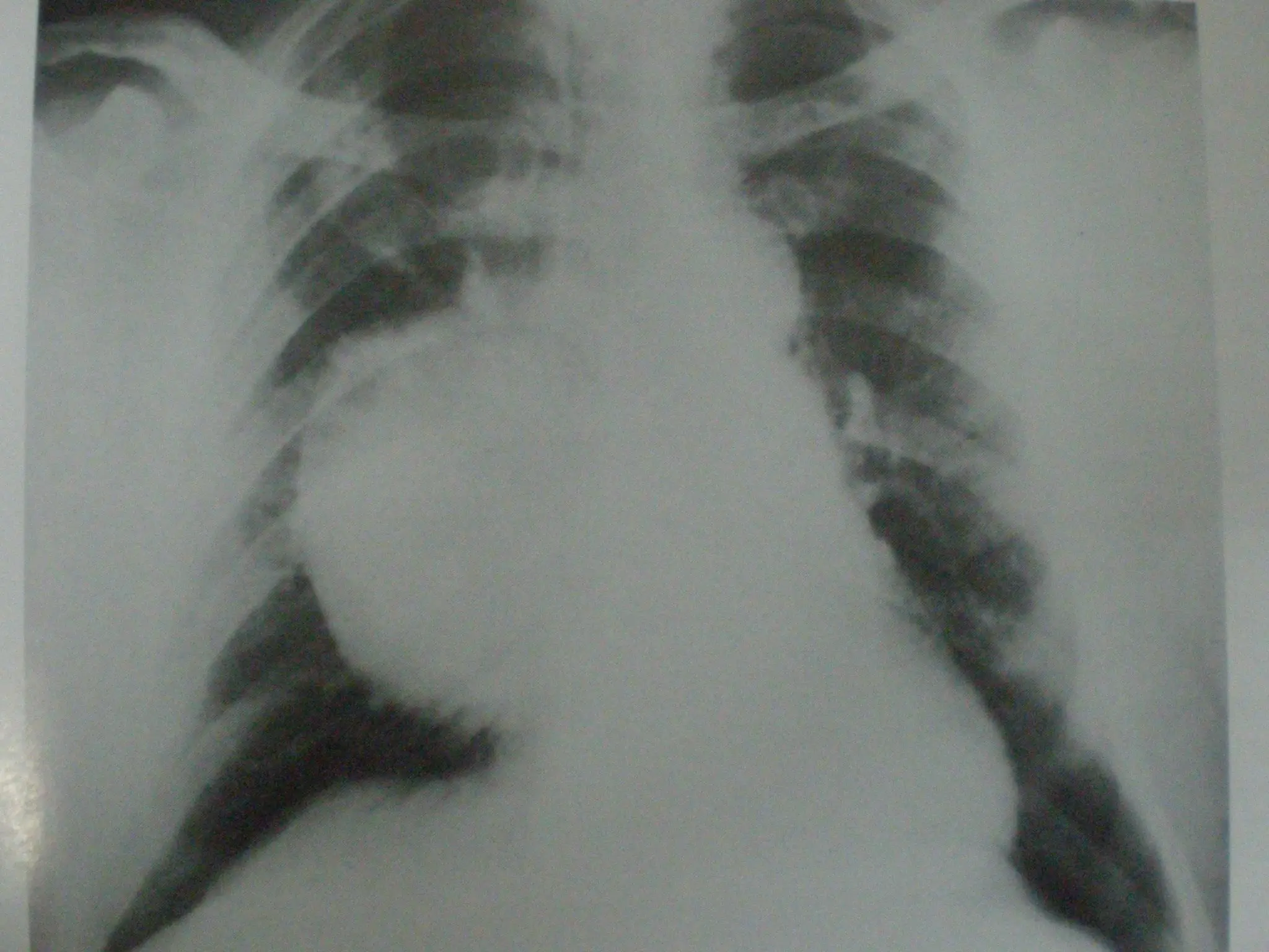 Mediastinal and lung masses xrays images radiology.pdf