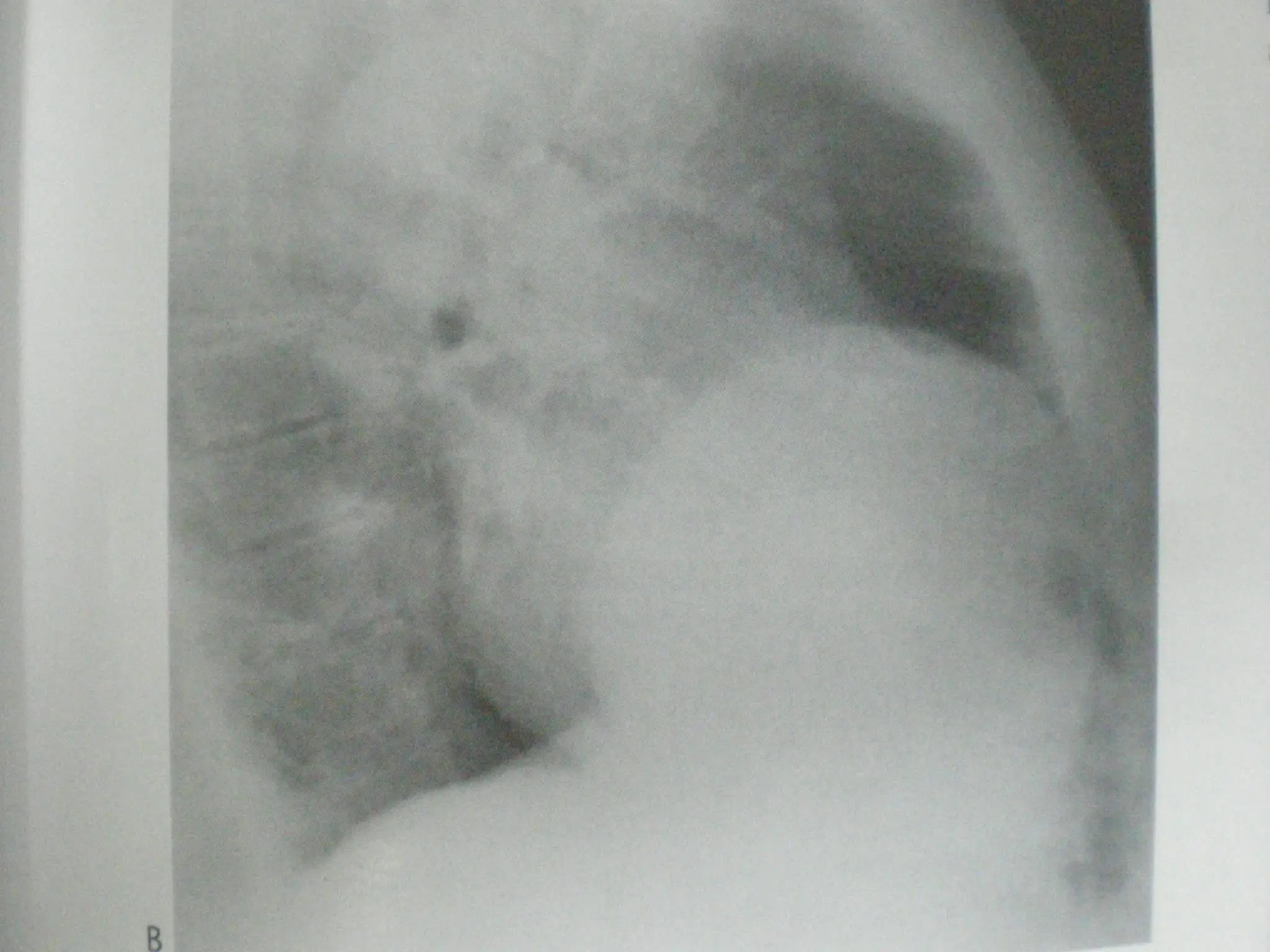 Mediastinal and lung masses xrays images radiology.pdf