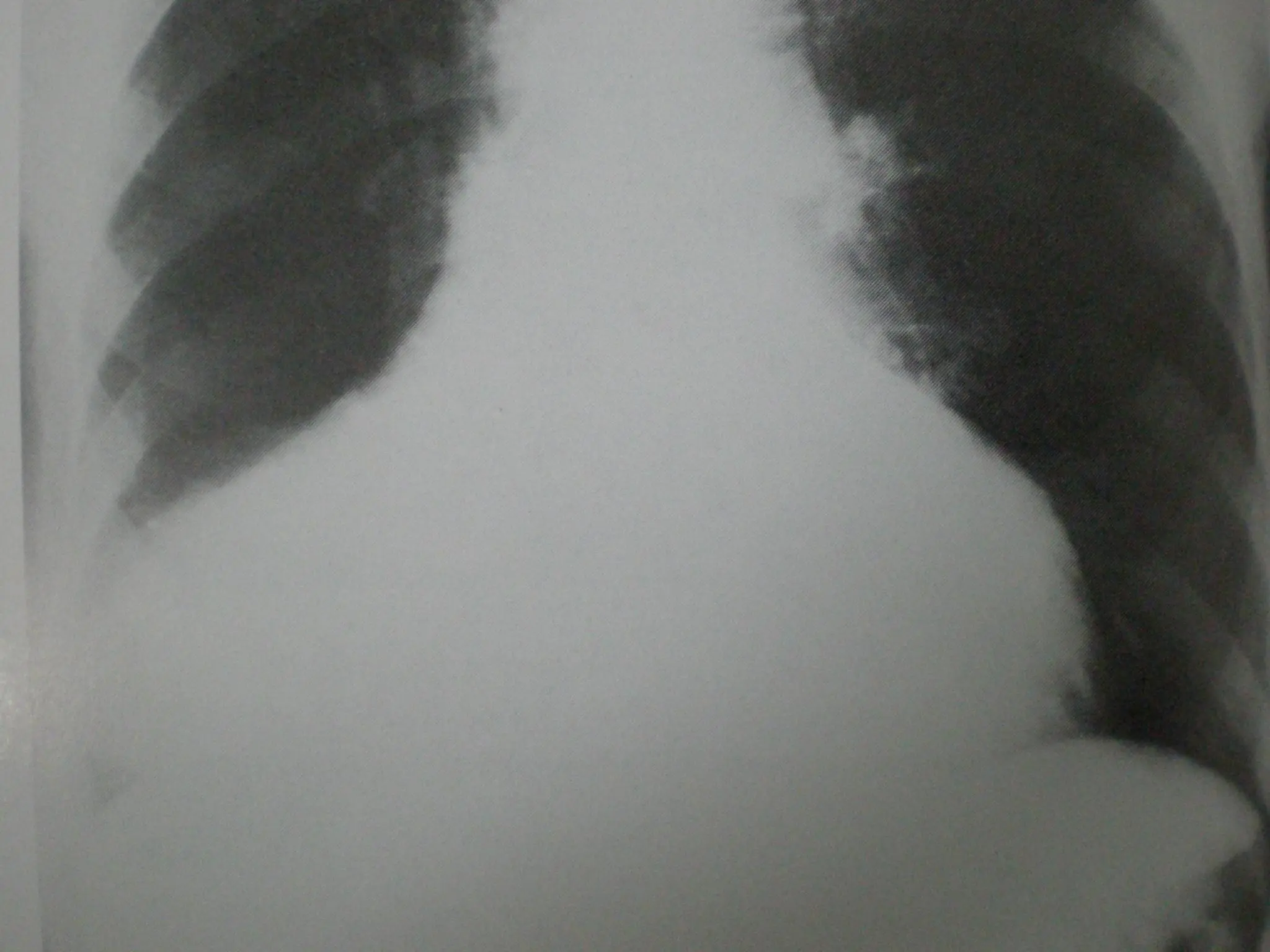 Mediastinal and lung masses xrays images radiology.pdf