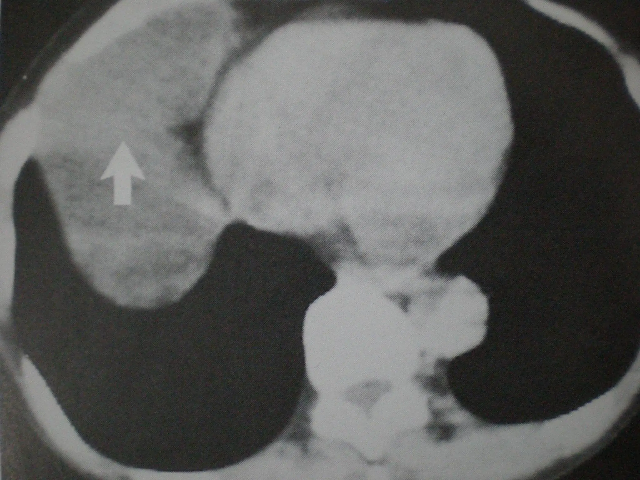 Mediastinal and lung masses xrays images radiology.pdf