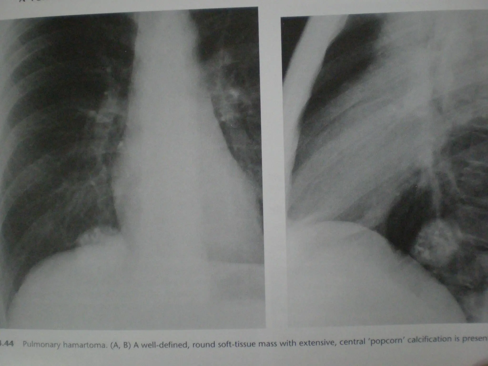 Mediastinal and lung masses xrays images radiology.pdf