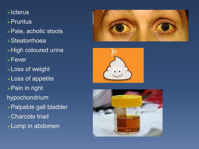 Obstruction jaundice and pathology of jaundice and symptoms | PDF ...