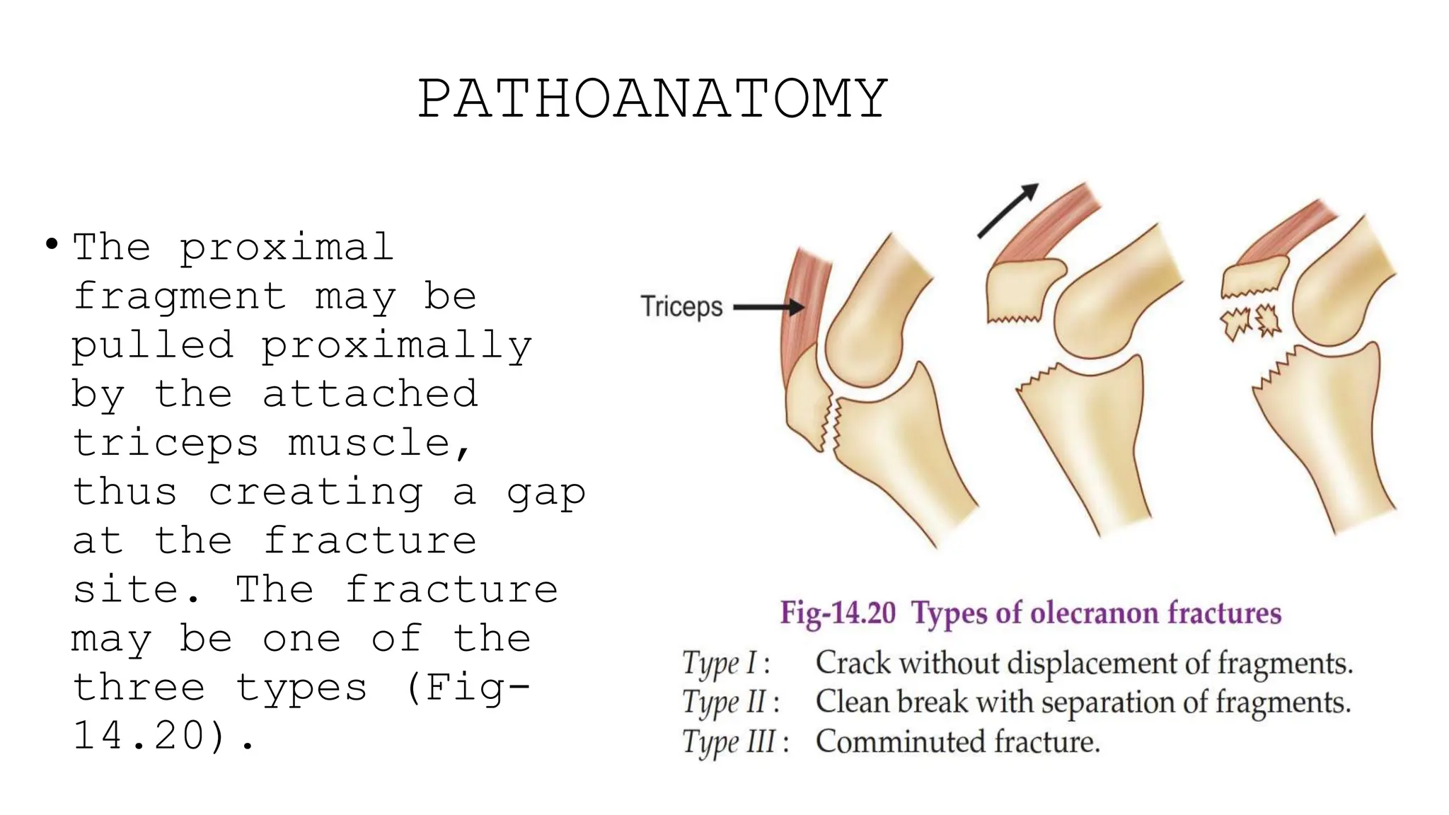 injuries around elbow joint orthopaedics ppt | PPTX