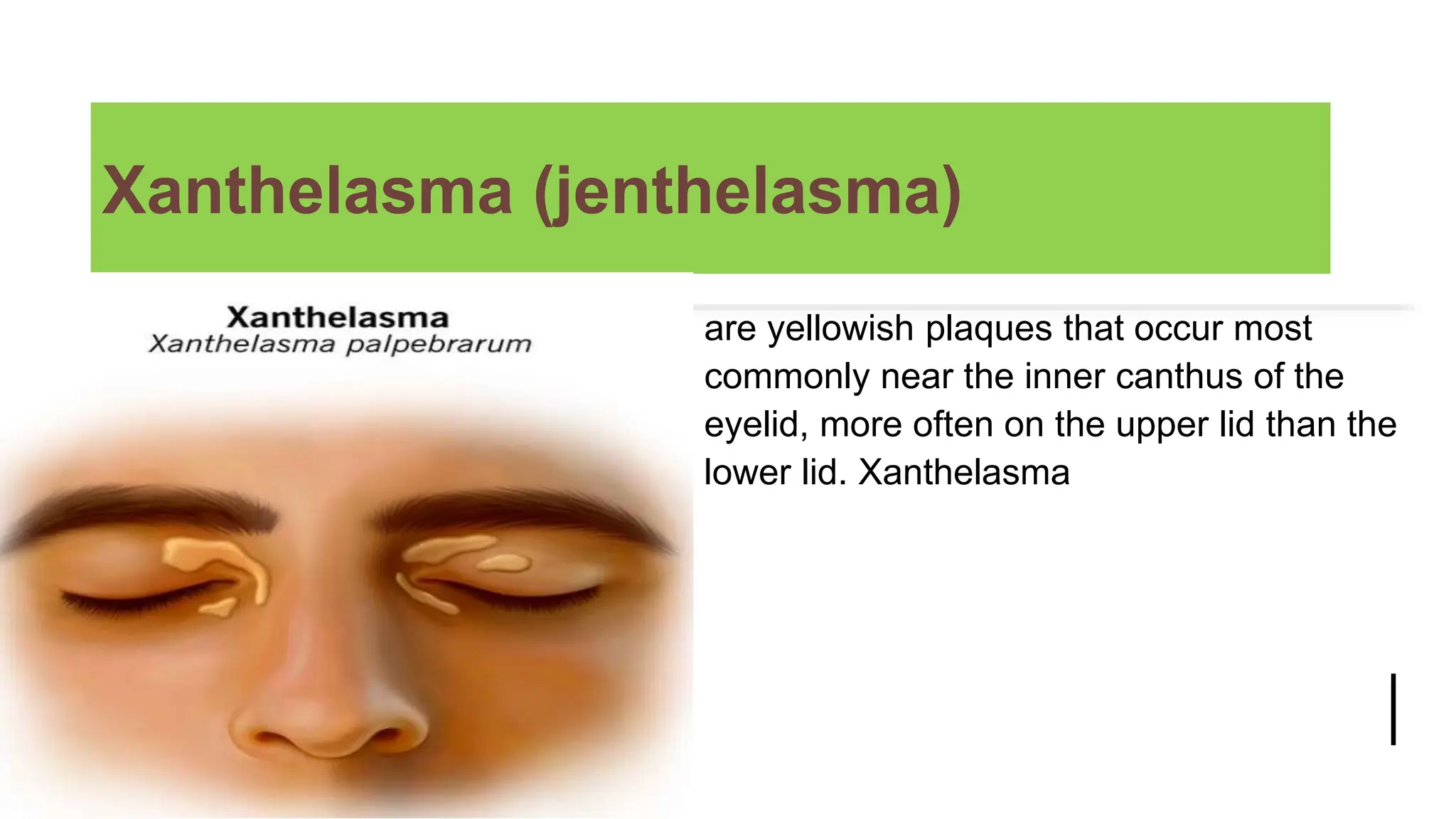 Eyelid deformities by Rutuja Mane bsc nursing | PPTX