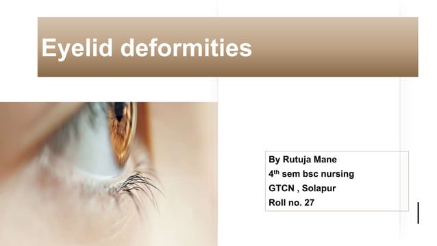 Eyelid deformities by Rutuja Mane bsc nursing | PPTX | Ear, Nose and Throat Conditions ...