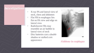 Foreign Bodies In ENT - Types, Clinical features, Investigations and ...