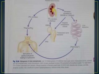 Diagnosis , staging , clinical features and management of CKD | PPTX