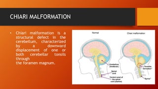 Fetal anomalies signs and symptoms diagnosis and management | PDF