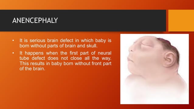 Fetal anomalies signs and symptoms diagnosis and management | PPT
