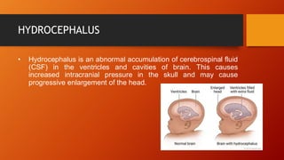 Fetal anomalies signs and symptoms diagnosis and management | PDF