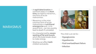 Malnutrition in Children: A Major Threat to the Under Nourished ...