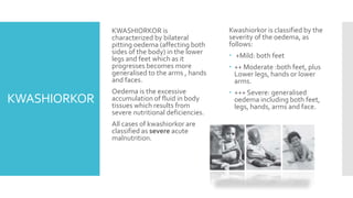 Malnutrition in Children: A Major Threat to the Under Nourished ...