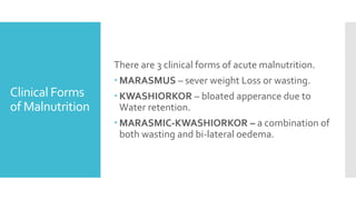 Malnutrition in Children: A Major Threat to the Under Nourished ...