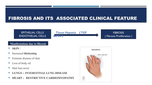 Systemic sclerosis an clinical approach.pptx