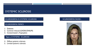 Systemic sclerosis an clinical approach.pptx