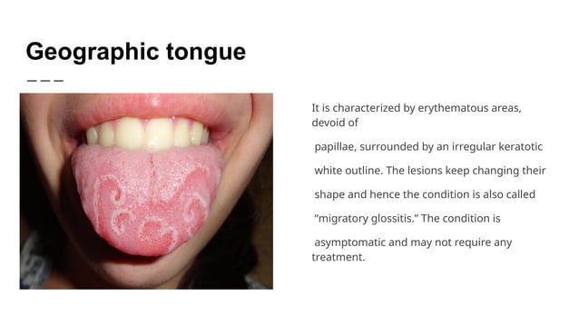Miscellaneous lesions of oral cavity and tongue | PPTX