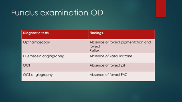 Foveal hypoplasia occurs due to the albinism case study | PPTX | Eye ...