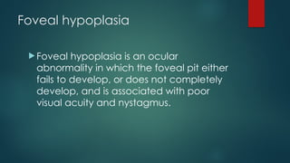 Foveal hypoplasia occurs due to the albinism case study | PPTX | Eye ...