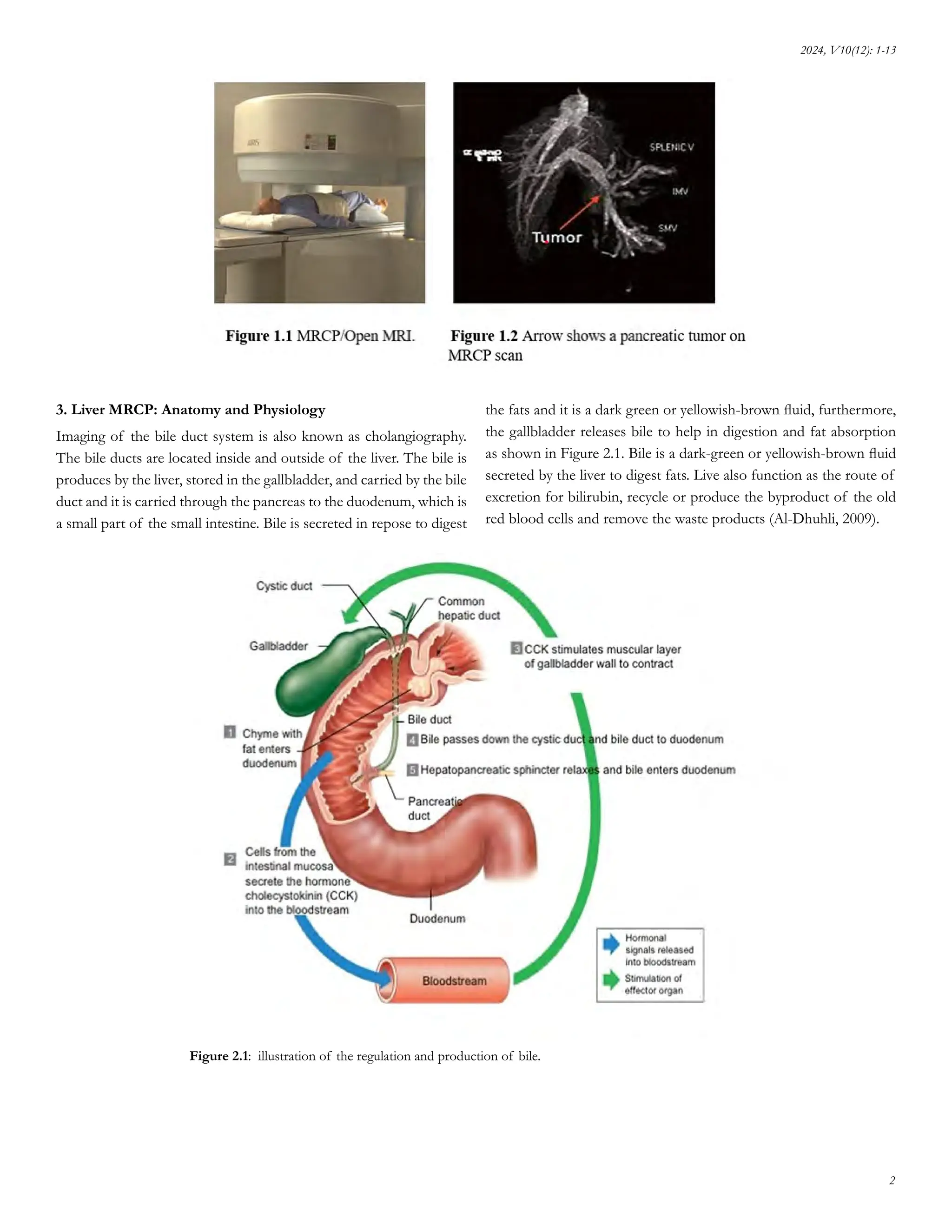 Magnetic Resonance Cholangiopancreatography (MRCP): Innovations in Non-Invasive Visualization of ...
