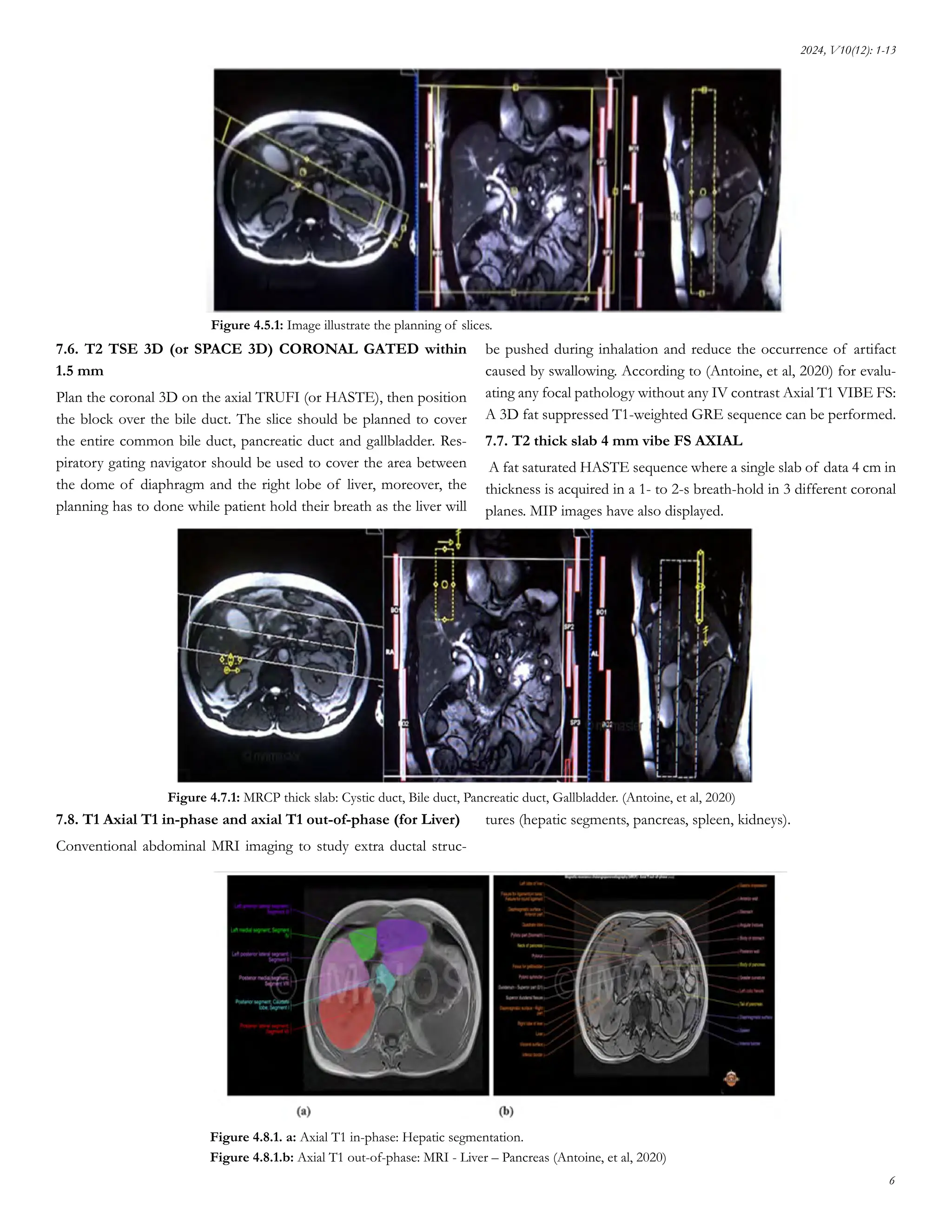 Magnetic Resonance Cholangiopancreatography (MRCP): Innovations in Non-Invasive Visualization of ...