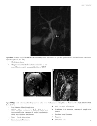 Magnetic Resonance Cholangiopancreatography (MRCP): Innovations in Non ...