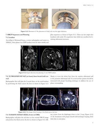 Magnetic Resonance Cholangiopancreatography (MRCP): Innovations in Non ...
