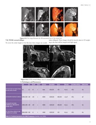 Magnetic Resonance Cholangiopancreatography (MRCP): Innovations in Non ...