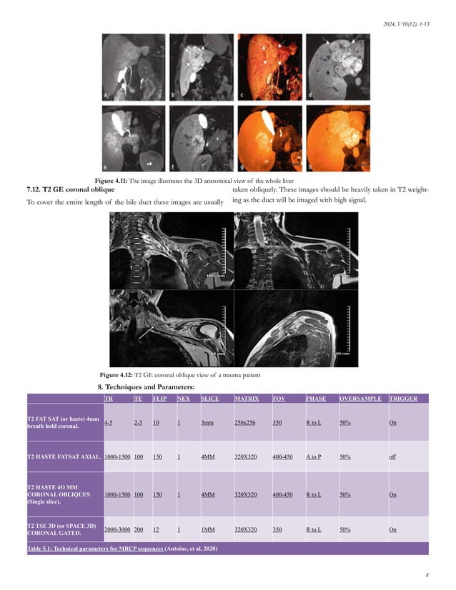Magnetic Resonance Cholangiopancreatography (MRCP): Innovations in Non-Invasive Visualization of ...