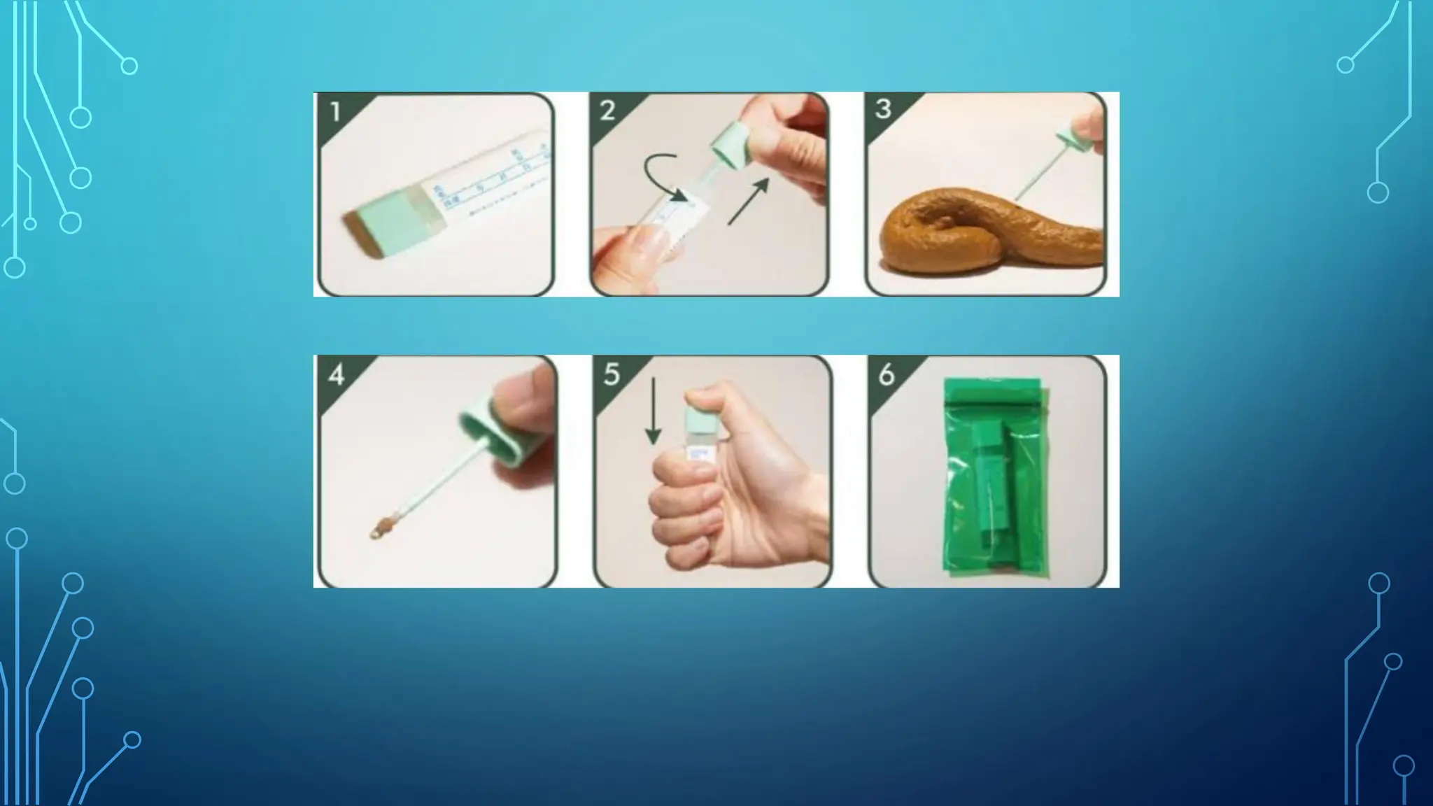 Clinical Laboratory Technology Stool Sample Collection And Processing Pdf