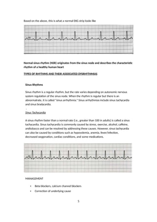 Analyzing cardiac rhythm shifts. Nursing Medsurg | PPTX
