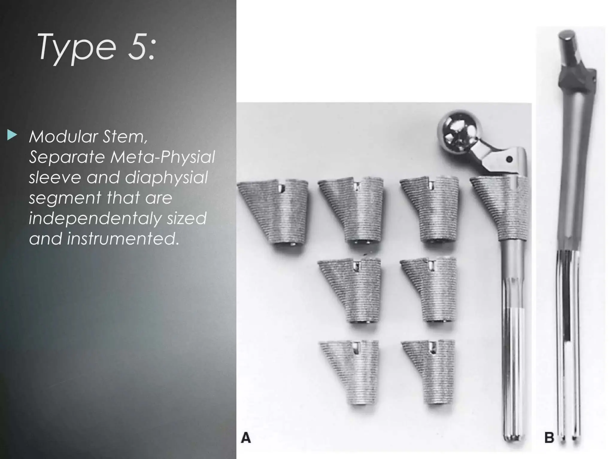 Total hip replacement and types of prosthesis | PPT