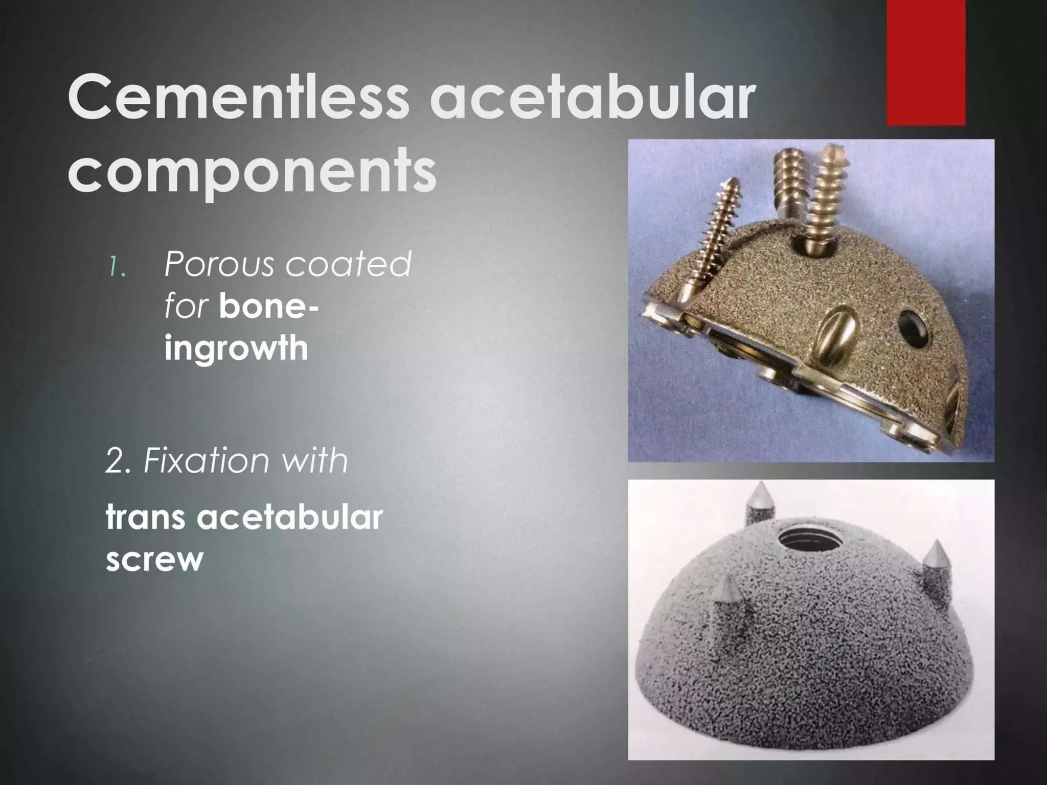 Total hip replacement and types of prosthesis | PPT