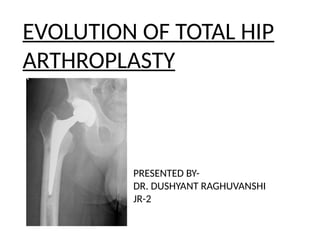 Total hip replacement and types of prosthesis | PPTX