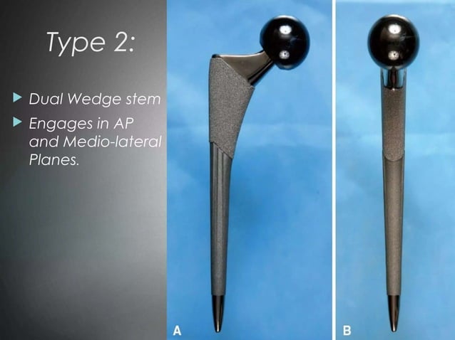 Total hip replacement and types of prosthesis | PPT
