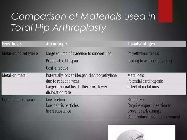 Total hip replacement and types of prosthesis | PPT