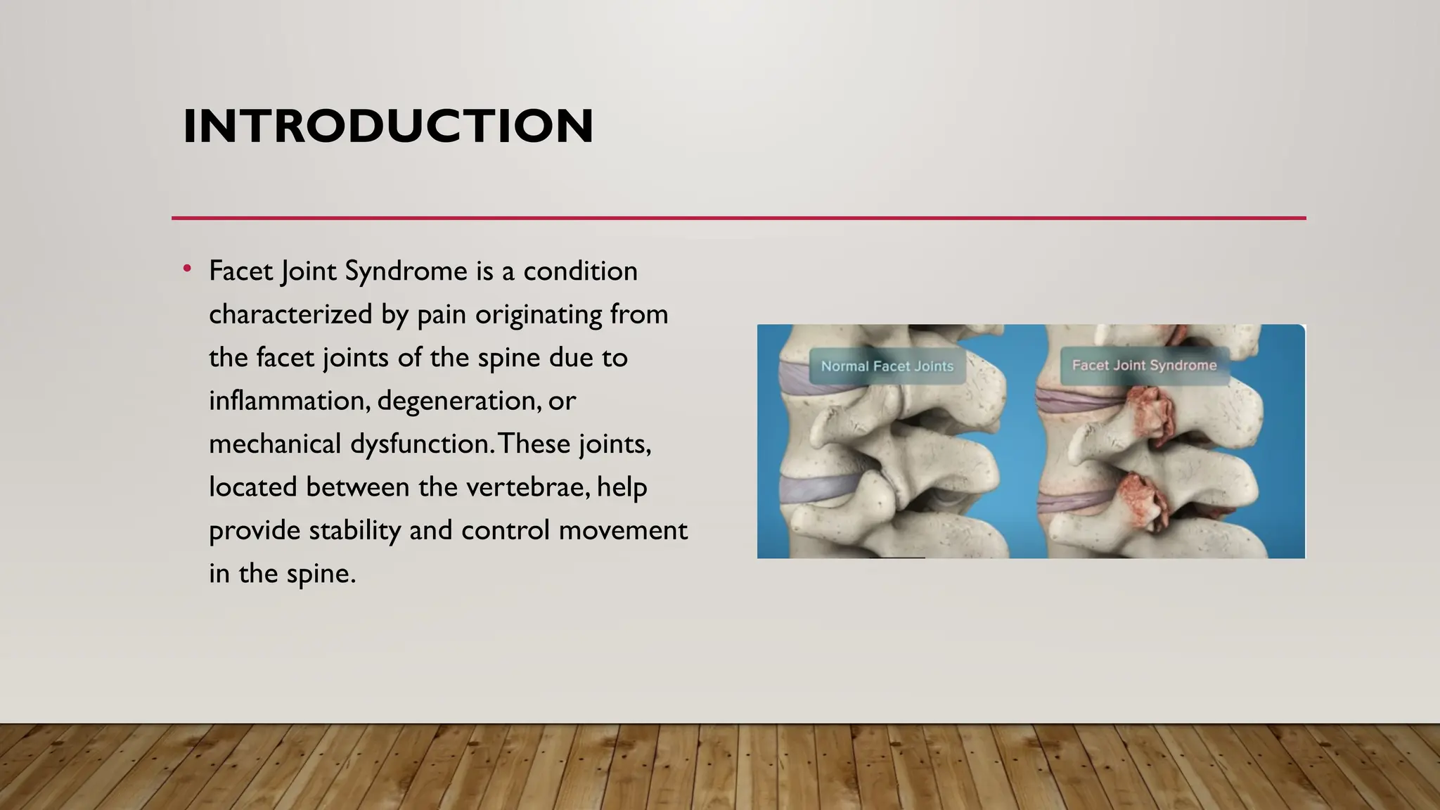 Facet joint syndrome for normal individuals.pptx