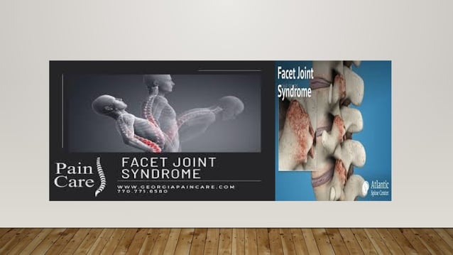 Facet joint syndrome for normal individuals.pptx