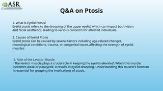 UNDERSTANDING PTOSIS:CAUSES,CLASSIFICATION, DIAGNOSIS, AND TREATMENT.pptx
