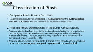 UNDERSTANDING PTOSIS:CAUSES,CLASSIFICATION, DIAGNOSIS, AND TREATMENT.pptx