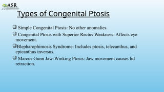 UNDERSTANDING PTOSIS:CAUSES,CLASSIFICATION, DIAGNOSIS, AND TREATMENT.pptx