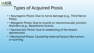 UNDERSTANDING PTOSIS:CAUSES,CLASSIFICATION, DIAGNOSIS, AND TREATMENT.pptx