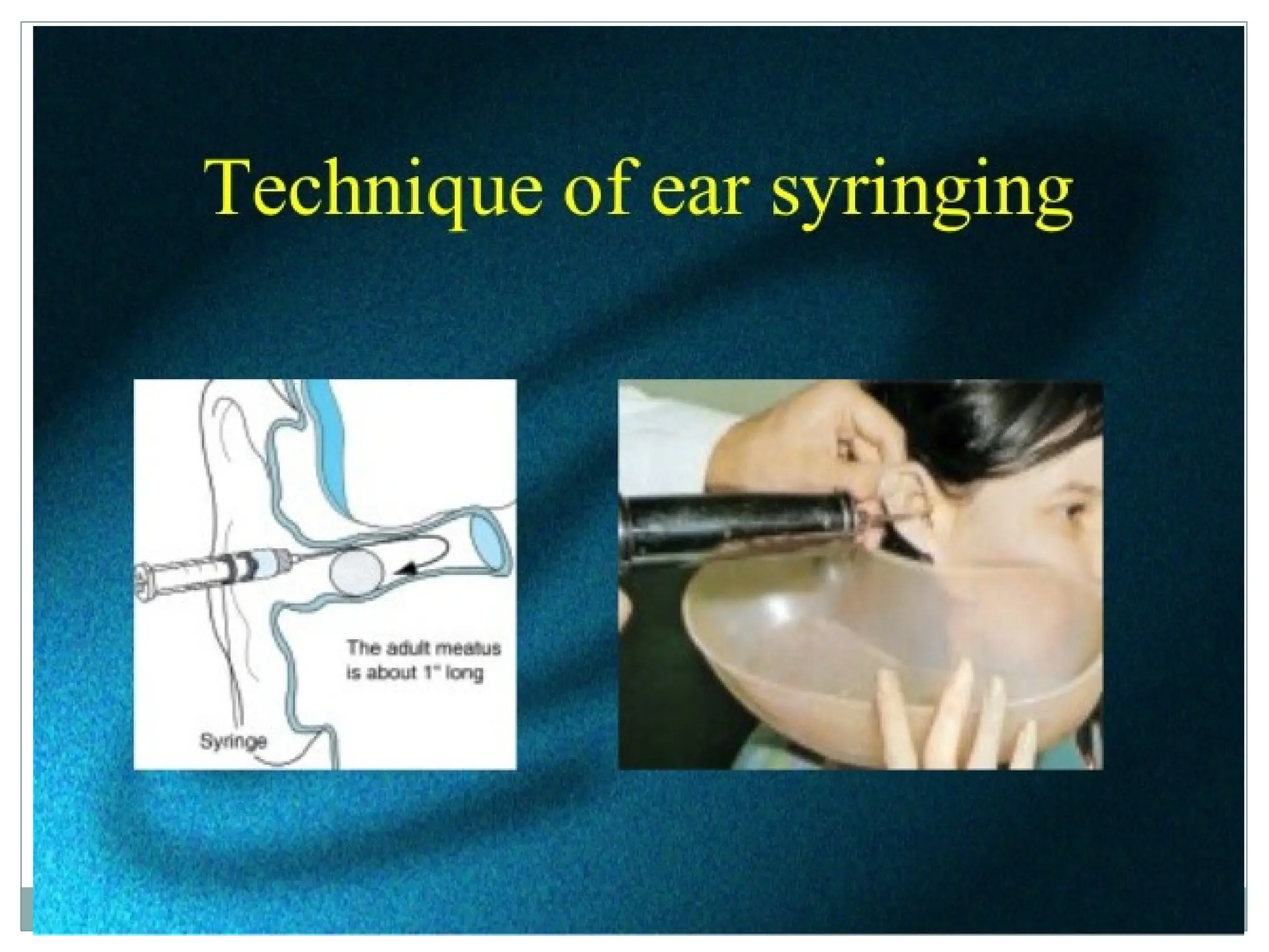 DOC-20250317-WA0050..pptx external ear dise | PPTX