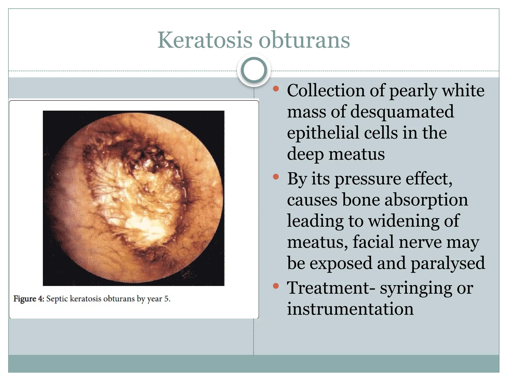 DOC-20250317-WA0050..pptx external ear dise | PPTX