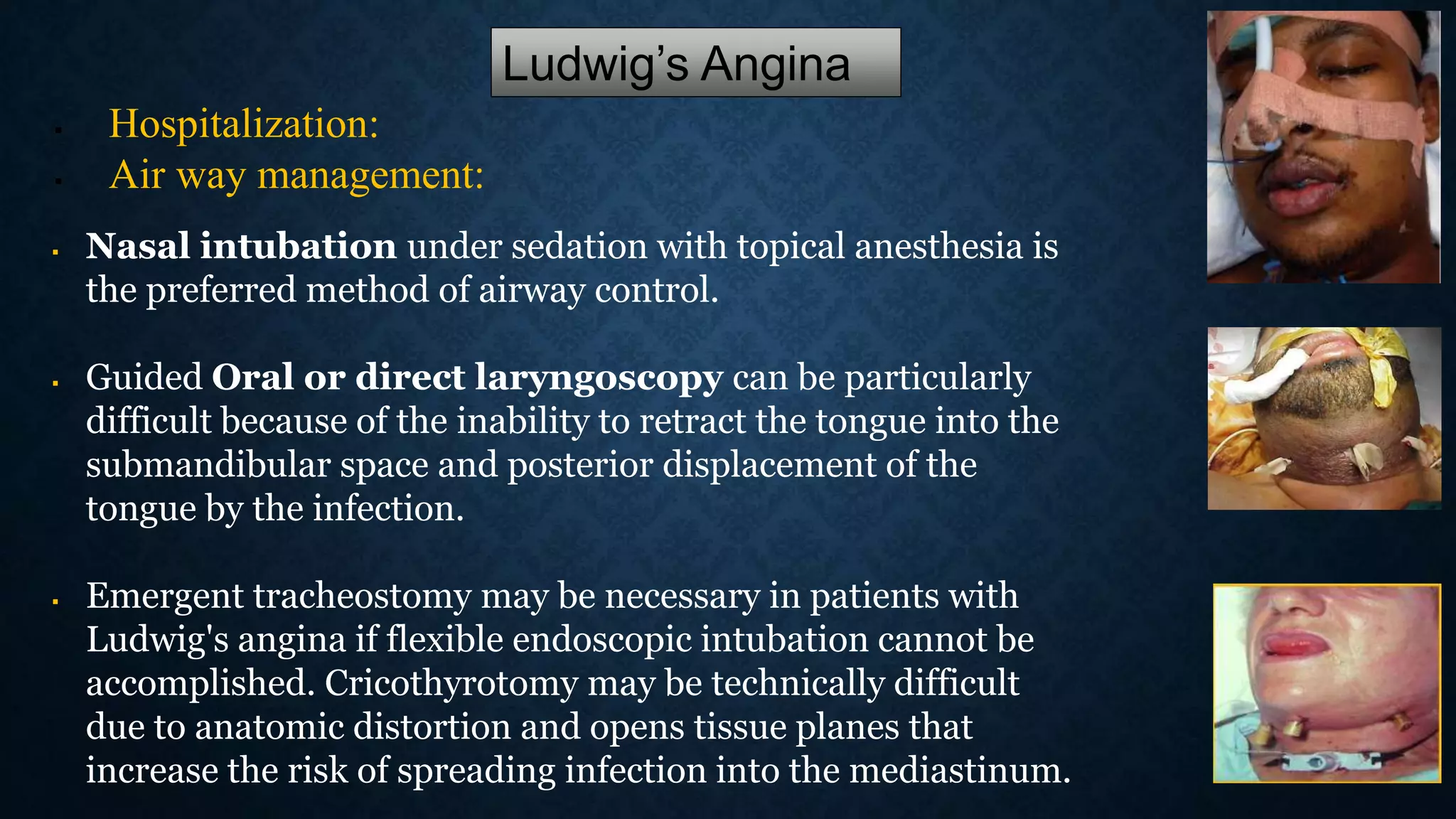 Fatal complications of maxillofacial infection | PPT