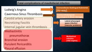 Fatal complications of maxillofacial infection | PPT
