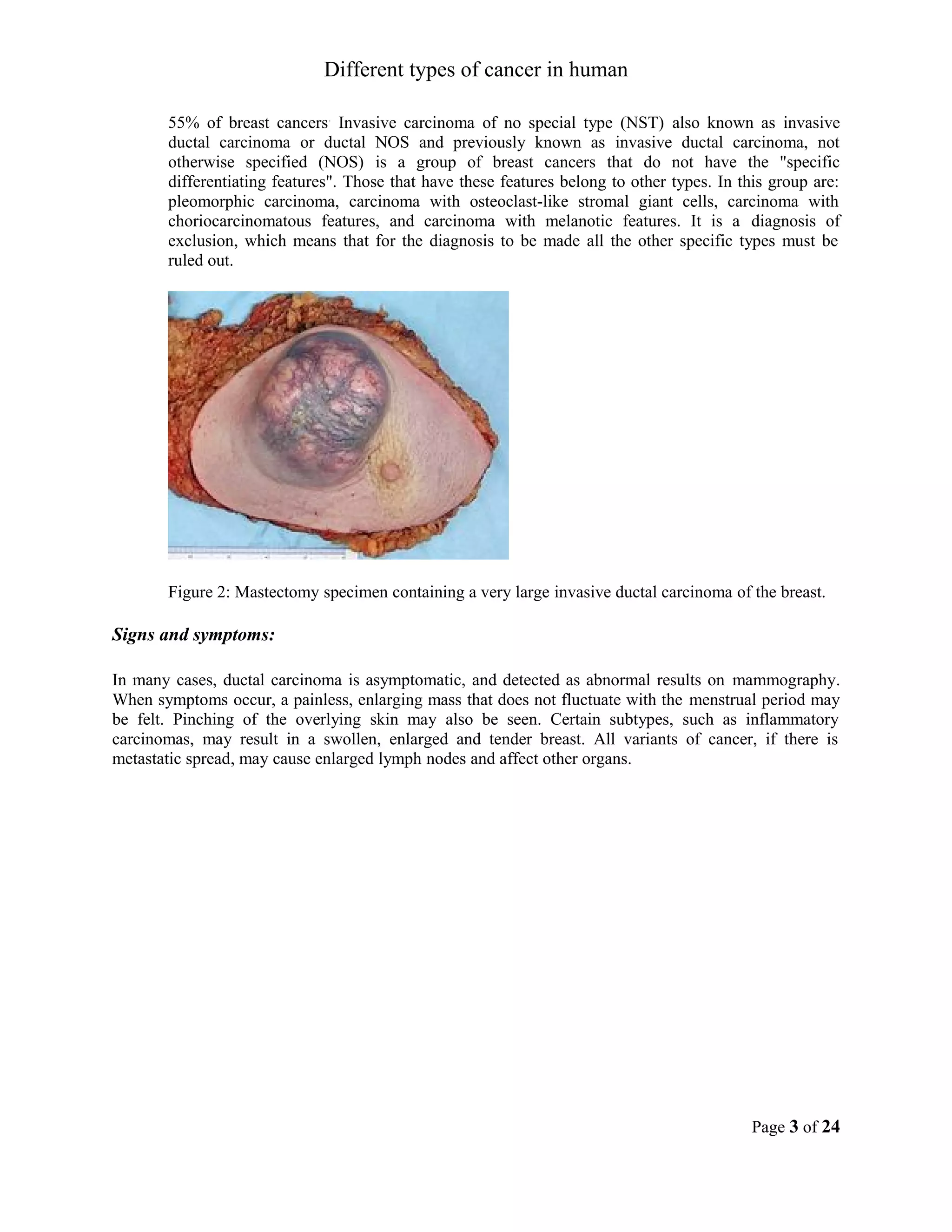 Different types of cancer occured in human body. | PDF