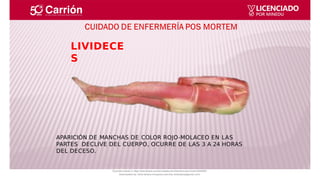 Cuidados de enfermeria postmortem Auxiliar de enfermería | PDF