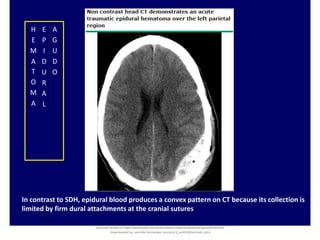 docsity-hematoma-subdural-panorama-general.pdf