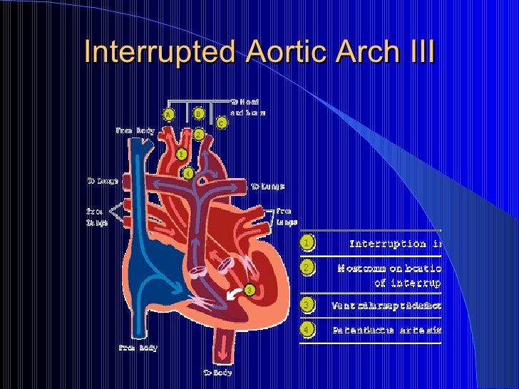 Docslide:congenital heart disease